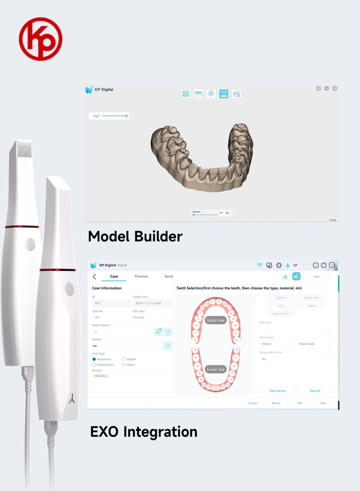 Kevin Peter Smile 2 Intraoral Scanner - Humayun Dental Supplies